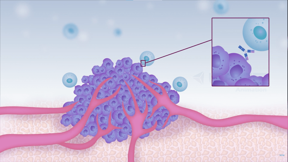 2D Medical Explainer Animation Service | EFFE Animation